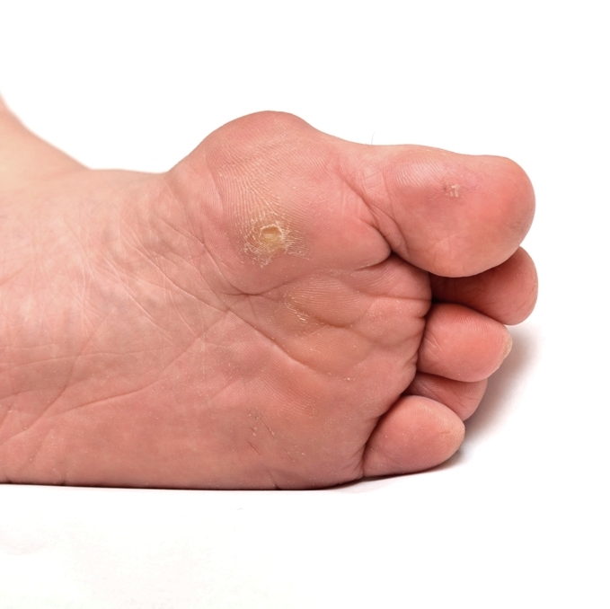 How I Help – Ruby Kallah Foot Clinic