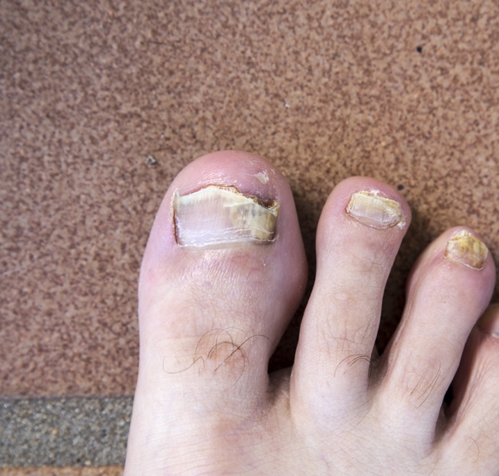 How I Help – Ruby Kallah Foot Clinic