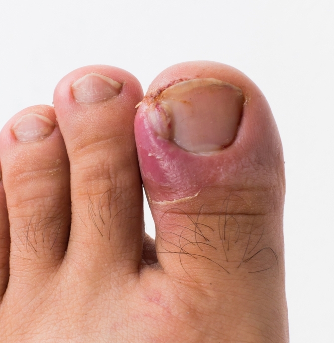 How I Help – Ruby Kallah Foot Clinic