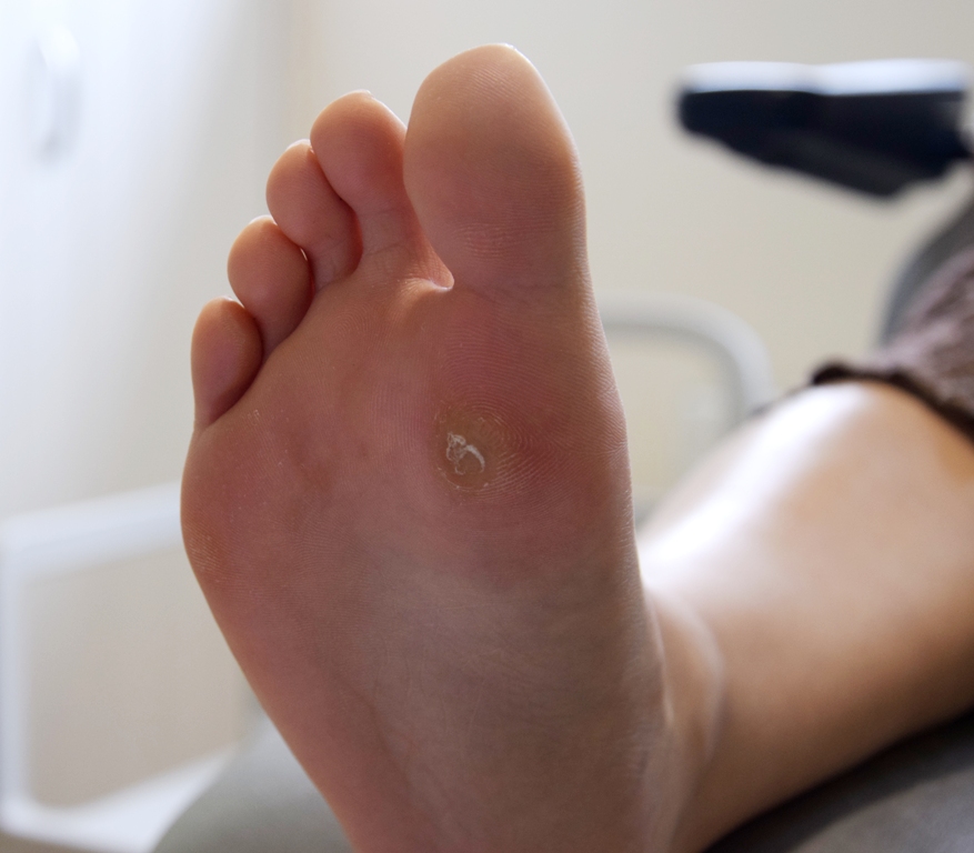 How I Help – Ruby Kallah Foot Clinic